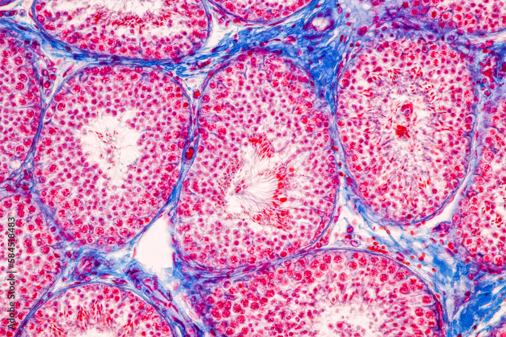Anatomy and Histological Epididymis and Testis human cells under ...