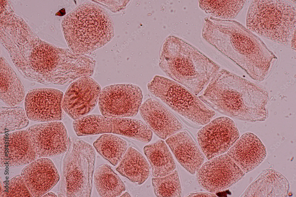 Root tip of Onion and Mitosis cell in the Root tip of Onion under a ...