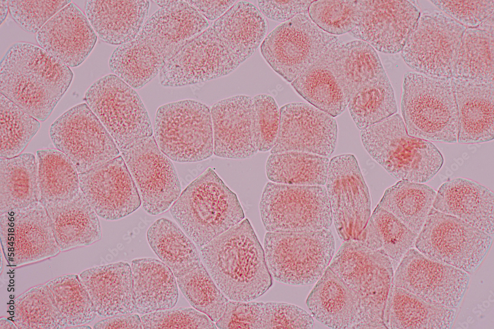 Root tip of Onion and Mitosis cell in the Root tip of Onion under a ...