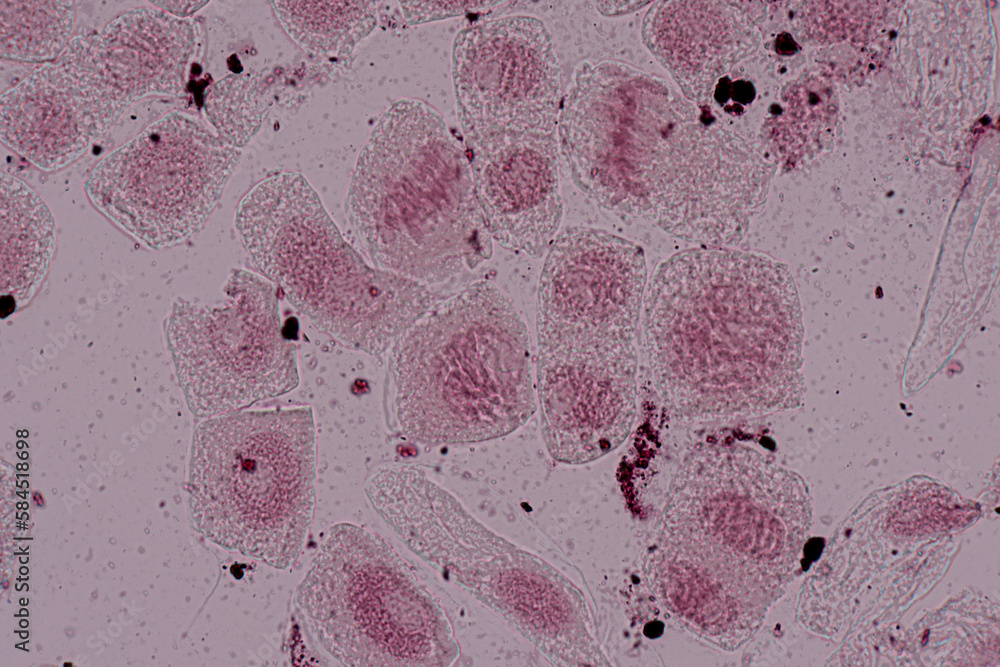 Root tip of Onion and Mitosis cell in the Root tip of Onion under a ...