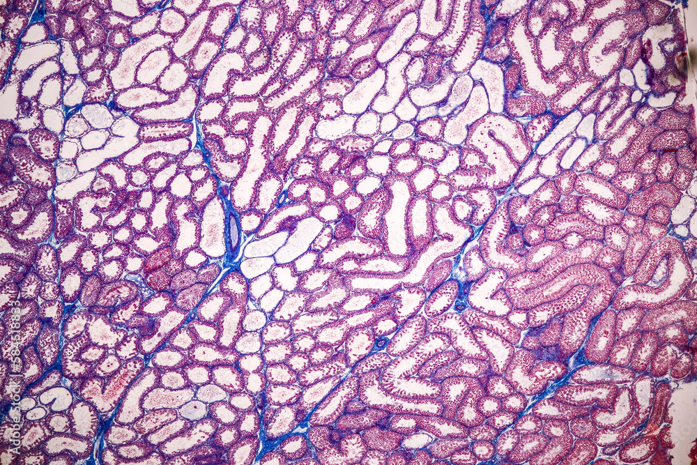 Anatomy and Histological Epididymis and Testis human cells under ...