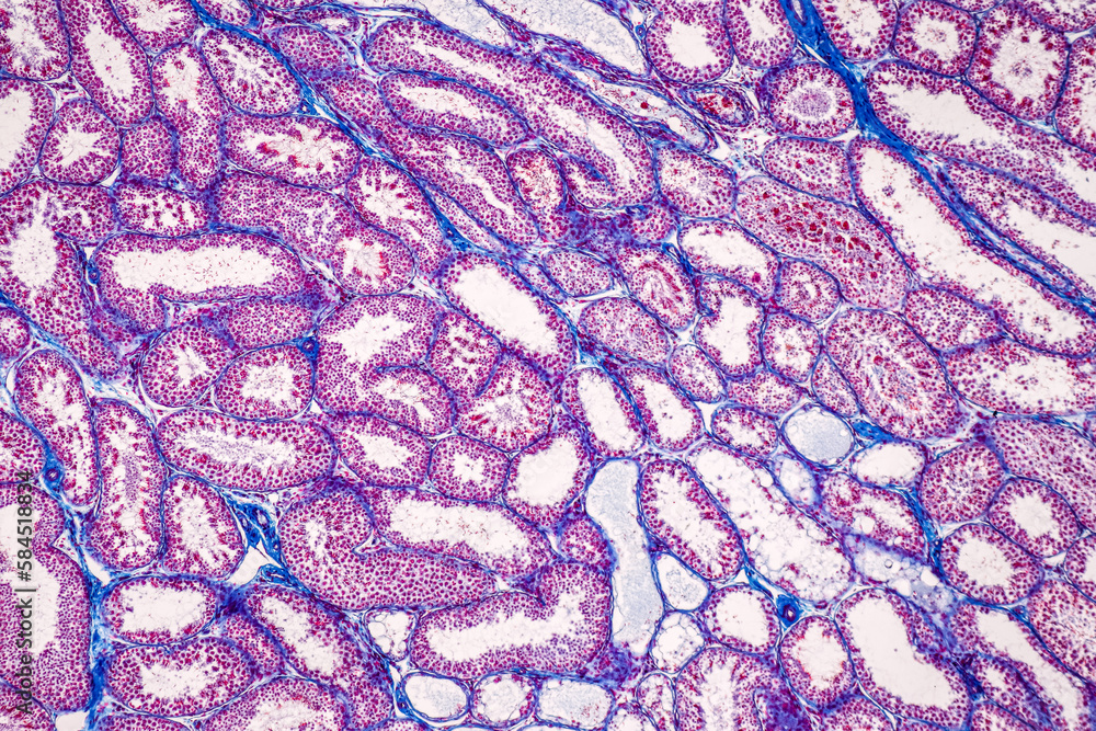 Anatomy and Histological Epididymis and Testis human cells under ...