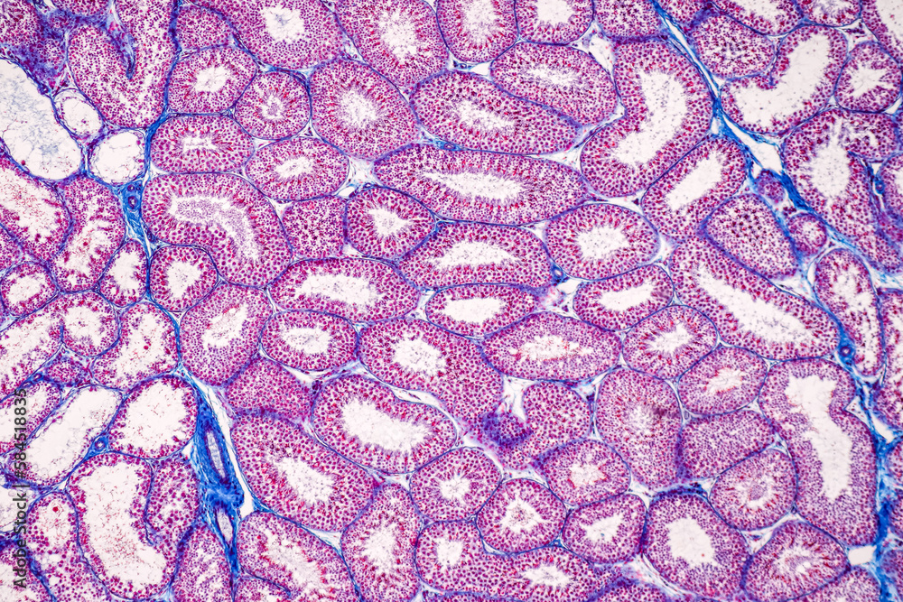 Anatomy and Histological Epididymis and Testis human cells under ...