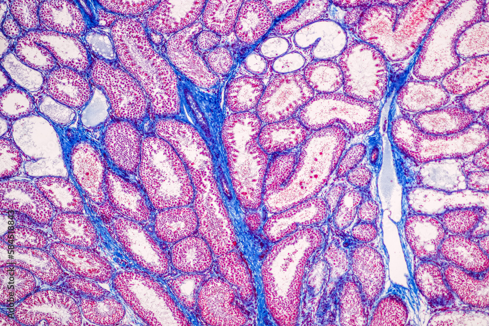 Anatomy and Histological Epididymis and Testis human cells under ...