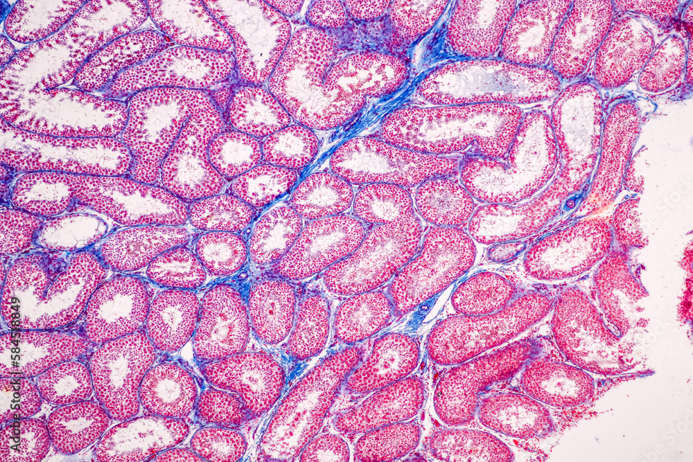 Anatomy and Histological Epididymis and Testis human cells under ...