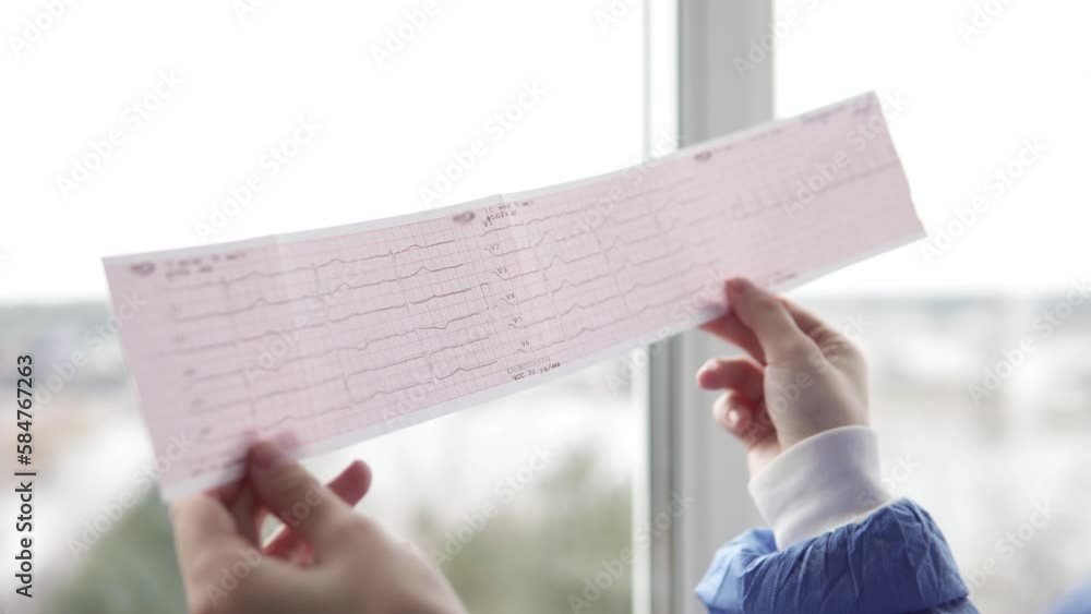 A cardiologist looks at a film of an electrocardiogram of a patient ...