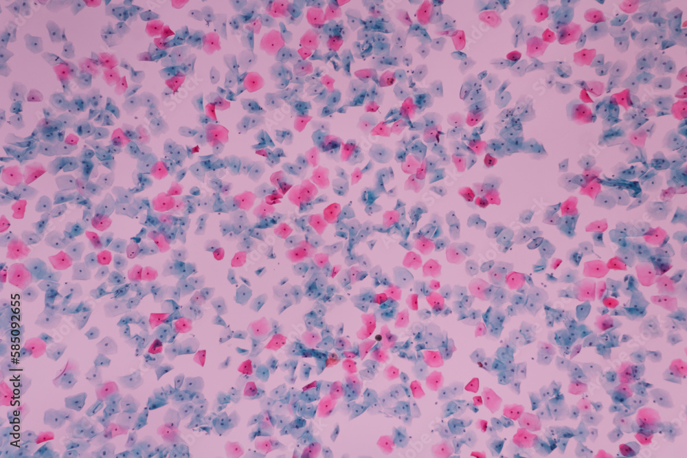 View in microscopic of normal human cervix cells.Squamous epithelial ...