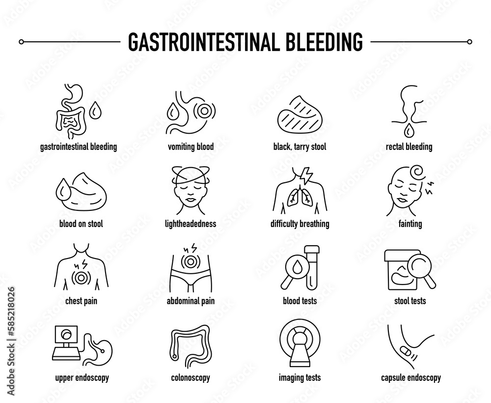Gastrointestinal Bleeding symptoms, diagnostic and treatment vector ...