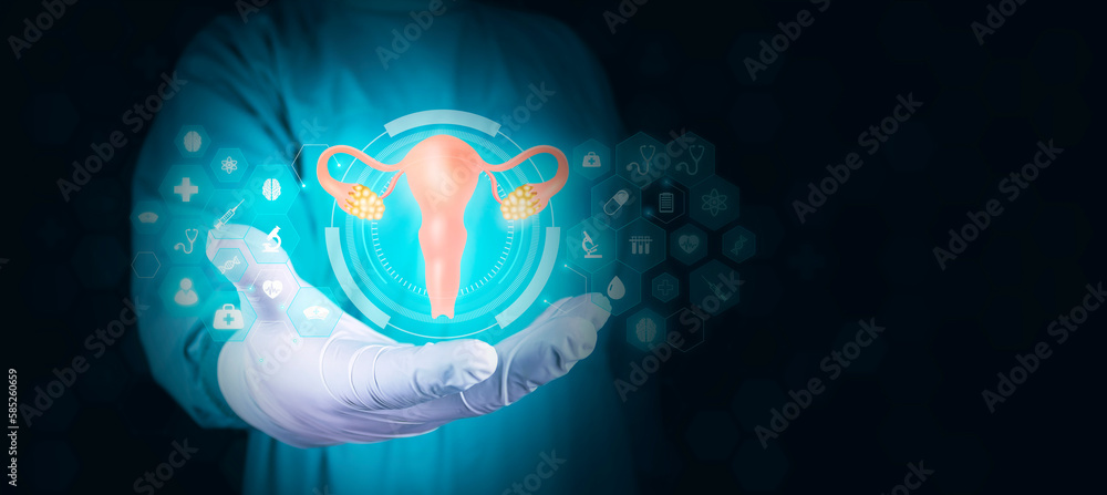 Female reproductive health concept. endometriosis, PCOS, gynecologic ...