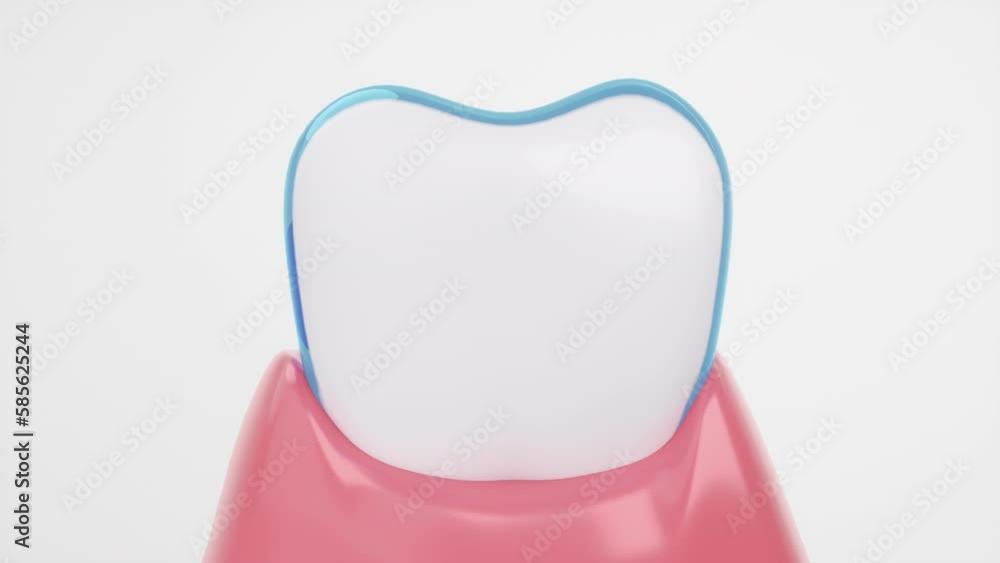 Blue fluoride bubble coating teeth and bright teeth to healthy white ...