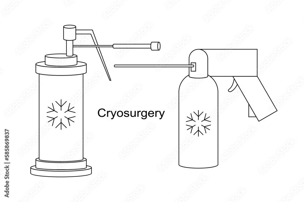Cryo instruments for Cryosurgery vector line illustration. Liquid ...