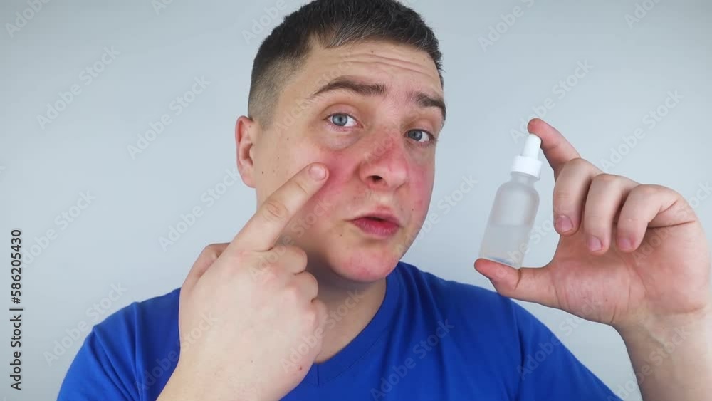 Azelaic acid. Man applies azelainates to her face. Laboratory research ...