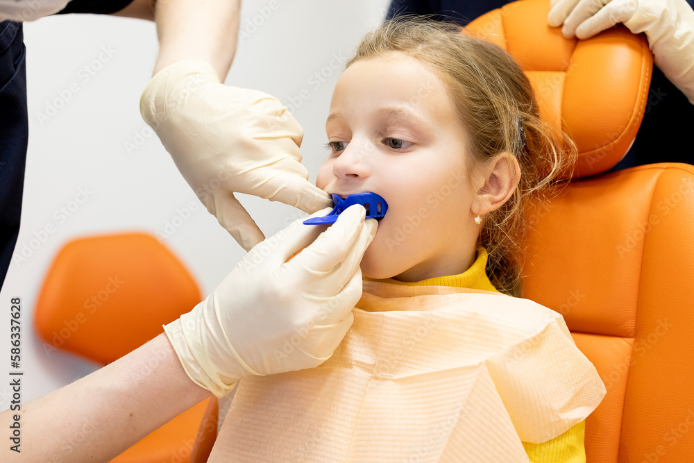 Orthodontist , tooth kids braces ,equipment teeth cast.Disorders of the ...