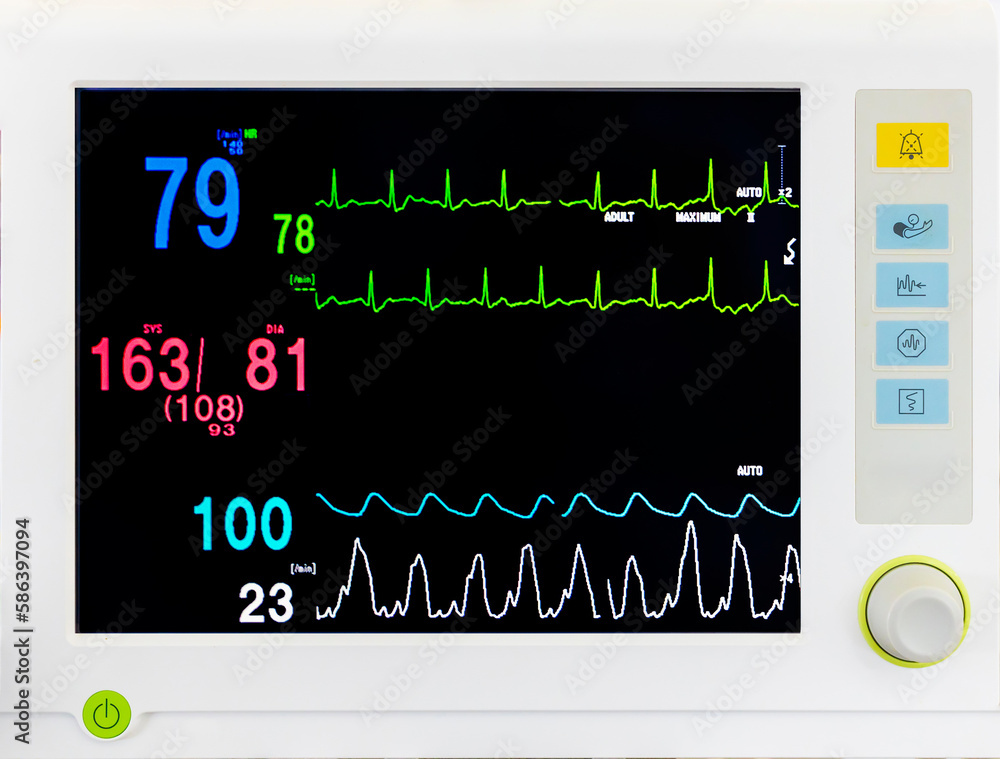 Medical vital sign monitor screen in operating room or hospital.Heart ...