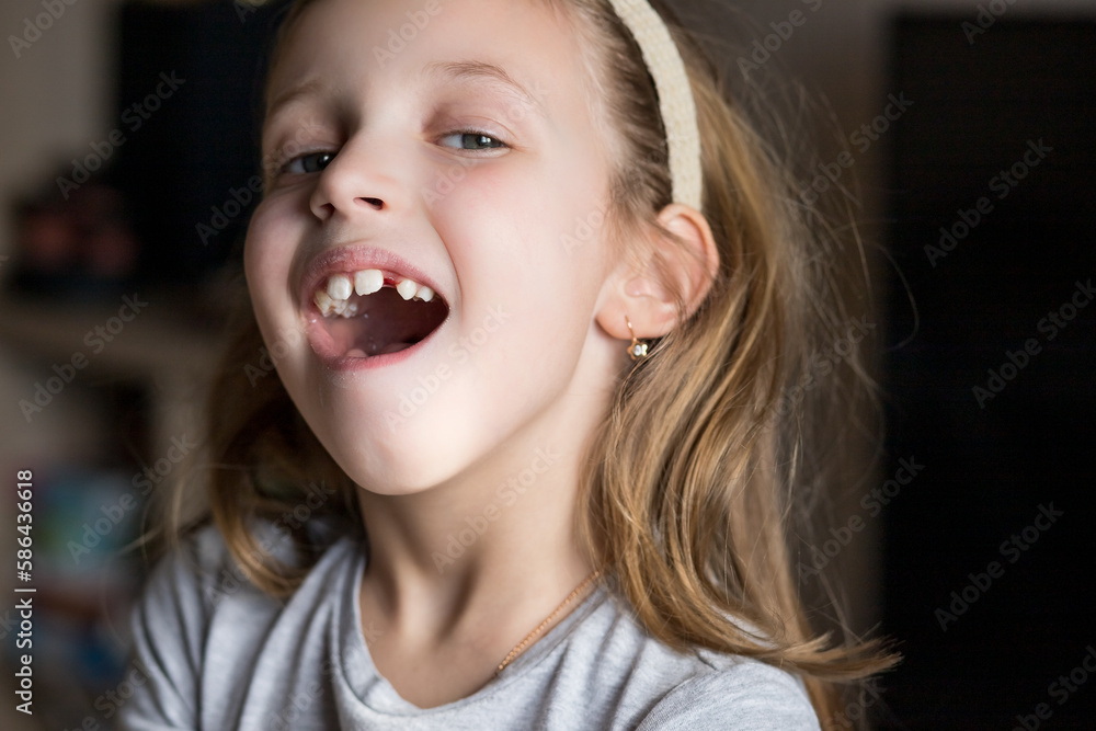 beautiful little girl of 6-7 years old lost the first milk tooth. Loss ...