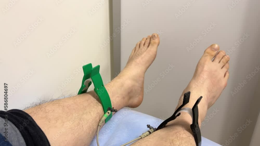 Electrode of ECG tracing of ill patient in the intensive care unit ECG ...