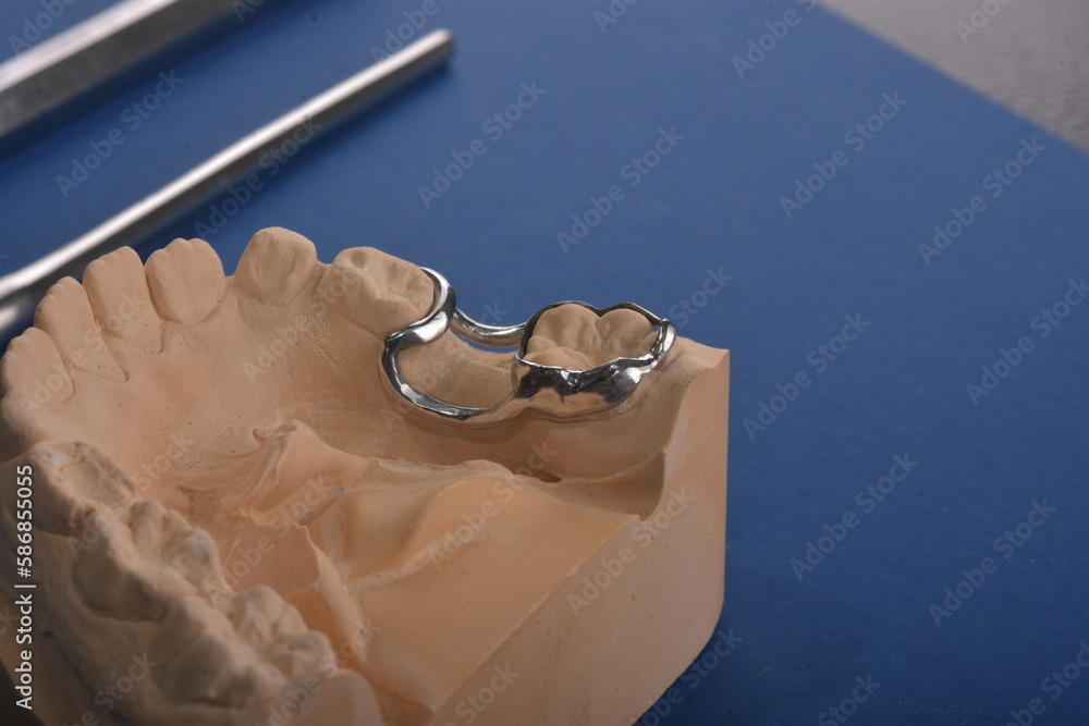 Maintaining proper spacing between teeth is crucial for a healthy and ...