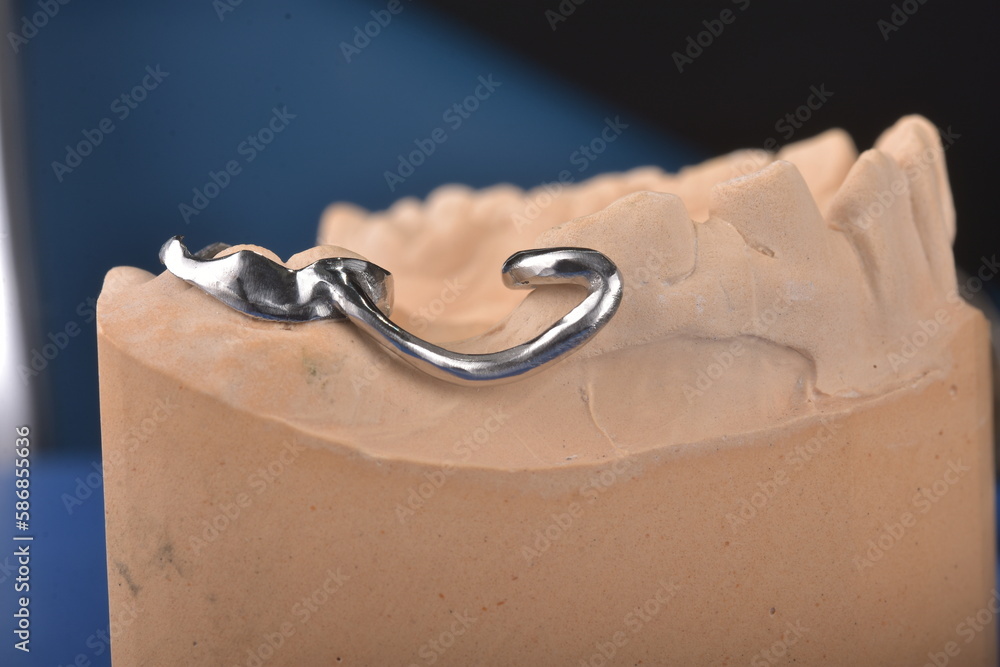 Maintaining proper spacing between teeth is crucial for a healthy and ...