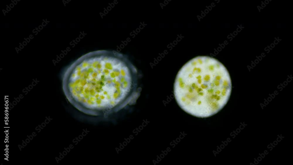 Ciliophora under a microscope, class Ciliata, possibly order ...