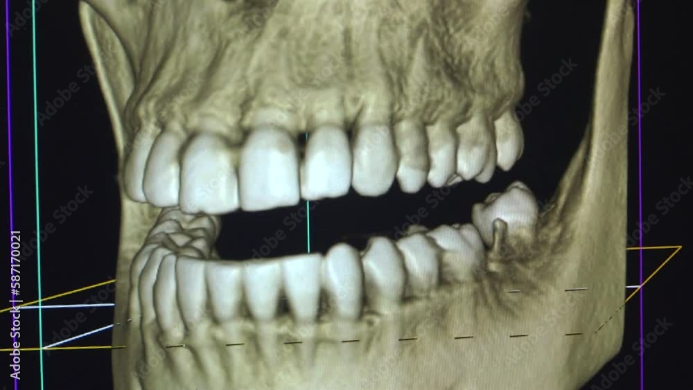 Vidéo Stock Modern medicine and technology. Panoramic radiograph showed ...