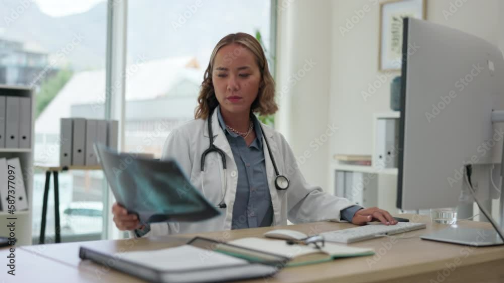 Asian woman, doctor and checking x ray on computer for healthcare ...