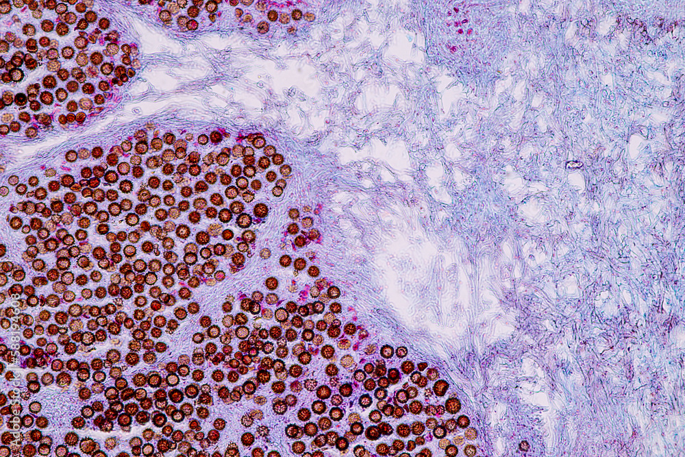 Host cells with spores (mold) are inside wood under the microscope for ...