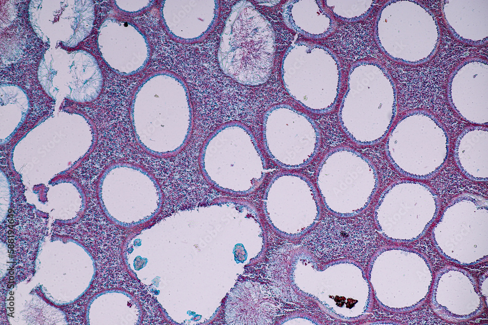 Host cells with spores (mold) are inside wood under the microscope for ...