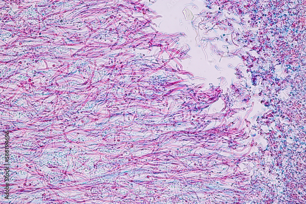 Host cells with spores (mold) are inside wood under the microscope for ...
