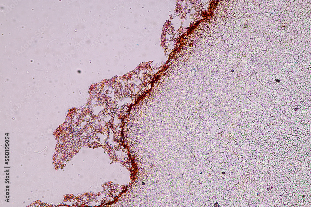 Host cells with spores (mold) are inside wood under the microscope for ...