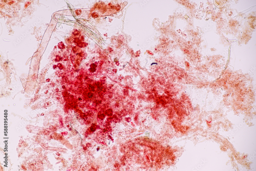 Host cells with spores (mold) are inside wood under the microscope for ...