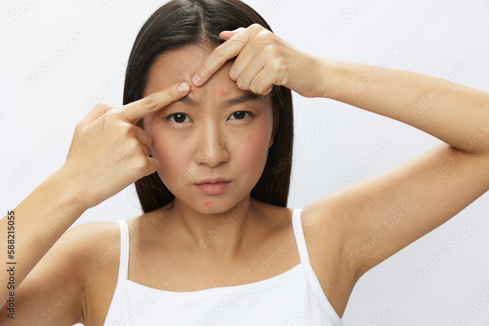 Asian woman facial skin problems, acne and inflammation, red rashes and ...