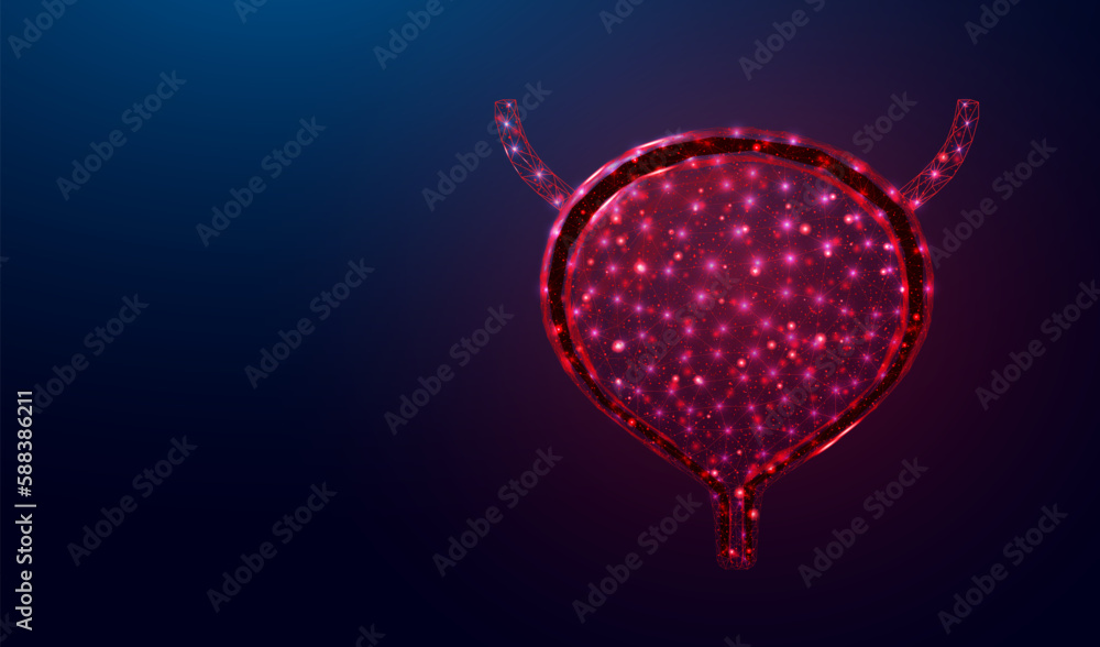 Human bladder. Design element for medical concept, bladder cancer ...