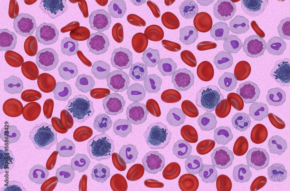 Acute myeloid leukemia (AML) cells in blood flow - microscopic view 3d ...