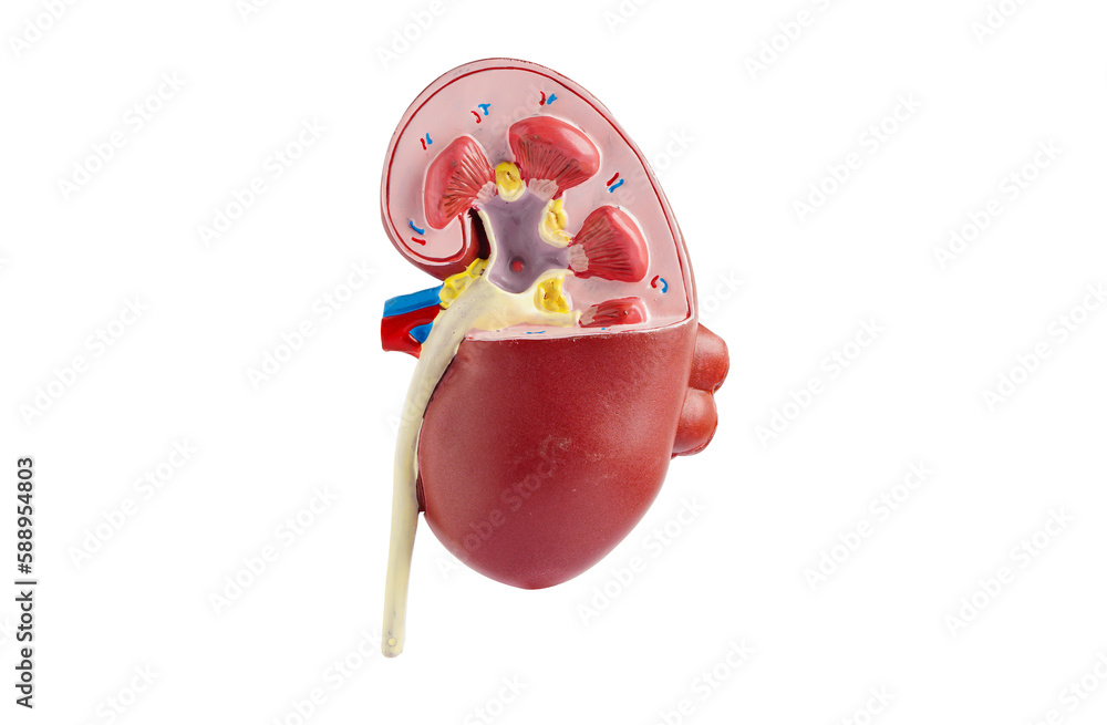 Kidney model isolated on white background with clipping path. Chronic ...