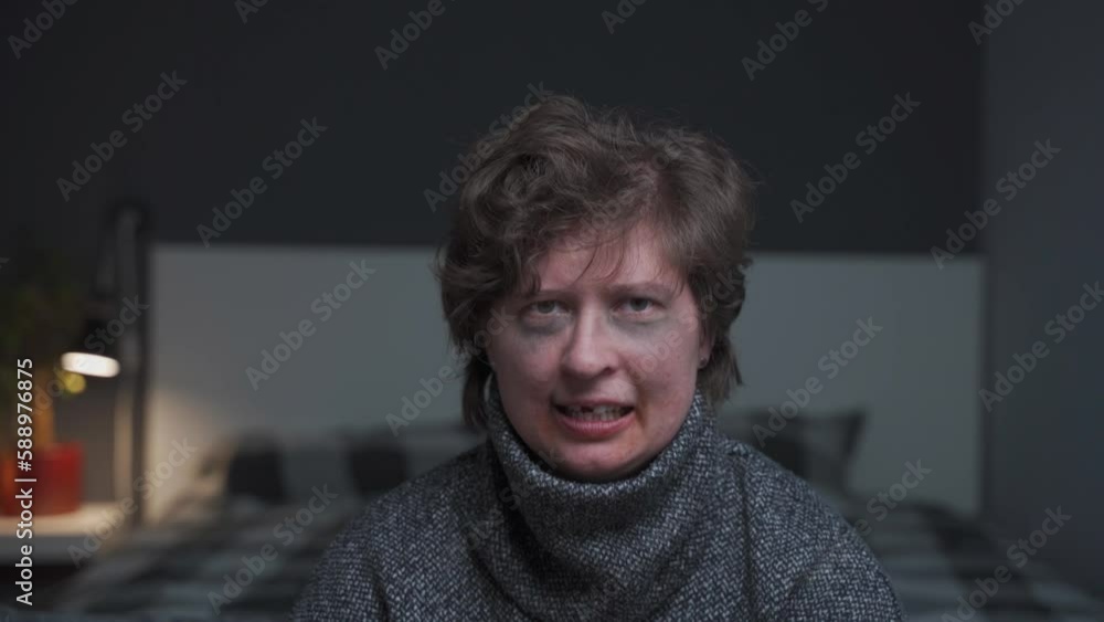 Vídeo do Stock: Young woman with injuries and trauma on face from ...