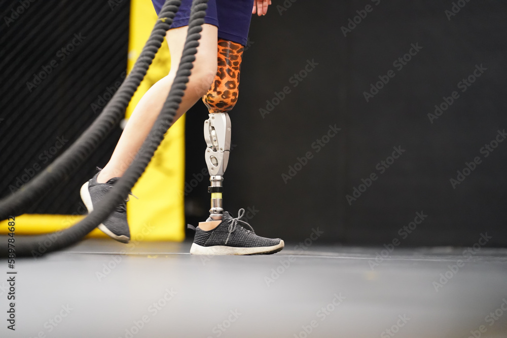 Young female with one prosthetic leg with doing arm and shoulder ...