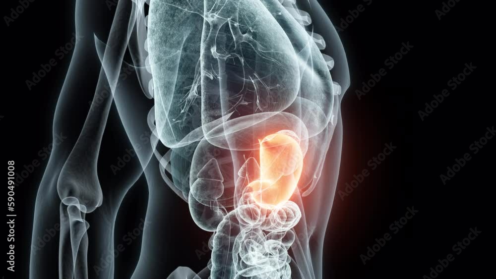 3D rendering Medical Animation of a Human Stomach.X-ray of a Stomach ...