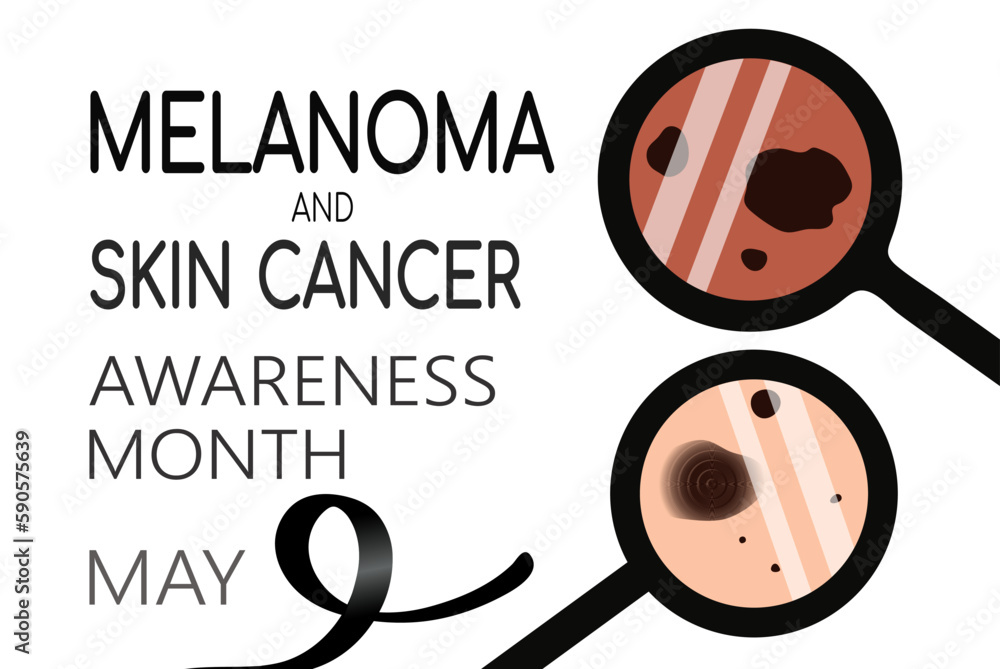 May is melanoma and skin cancer awareness month background template ...