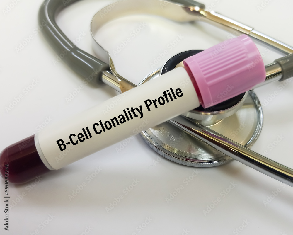 Blood sample for B-Cell Clonality profile (IgH and IgK) by PCR test to ...