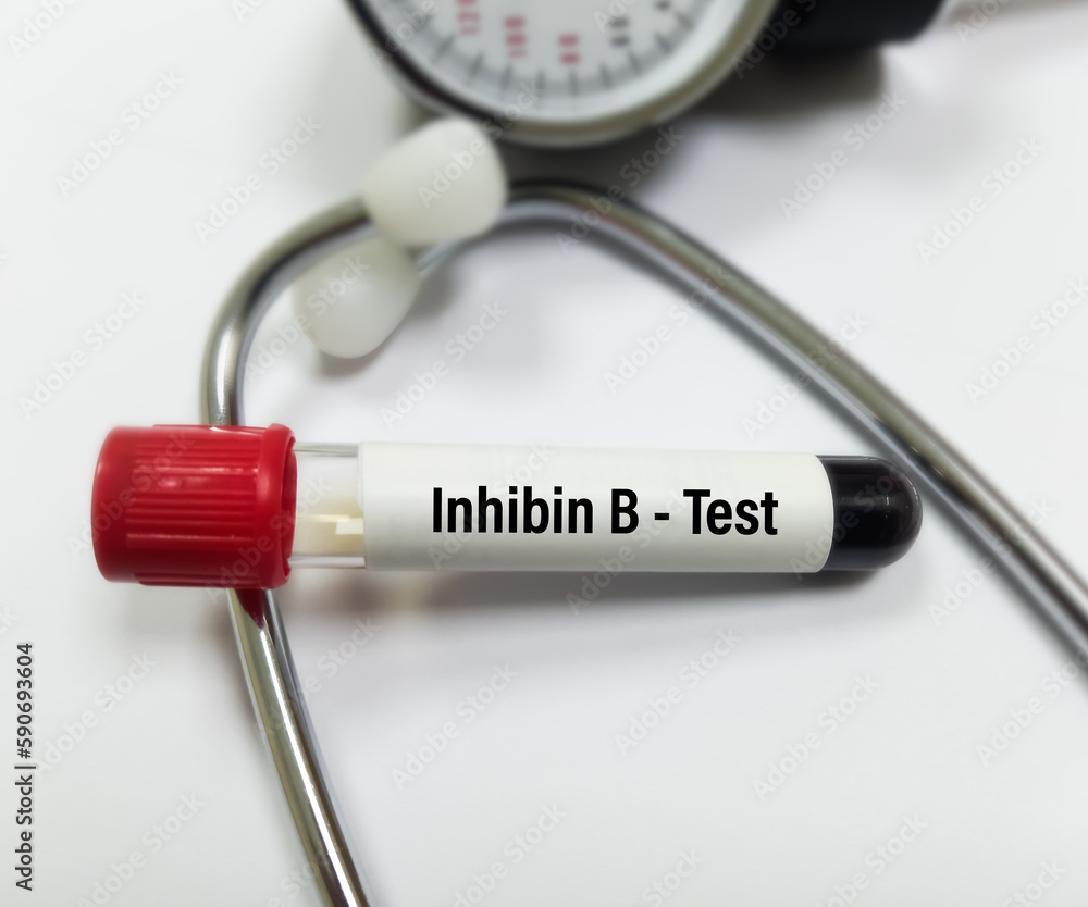 Blood sample for Inhibin B test, tumor marker tests measure these blood ... Blood sample for Inhibin B test, tumor marker tests measure these blood ...