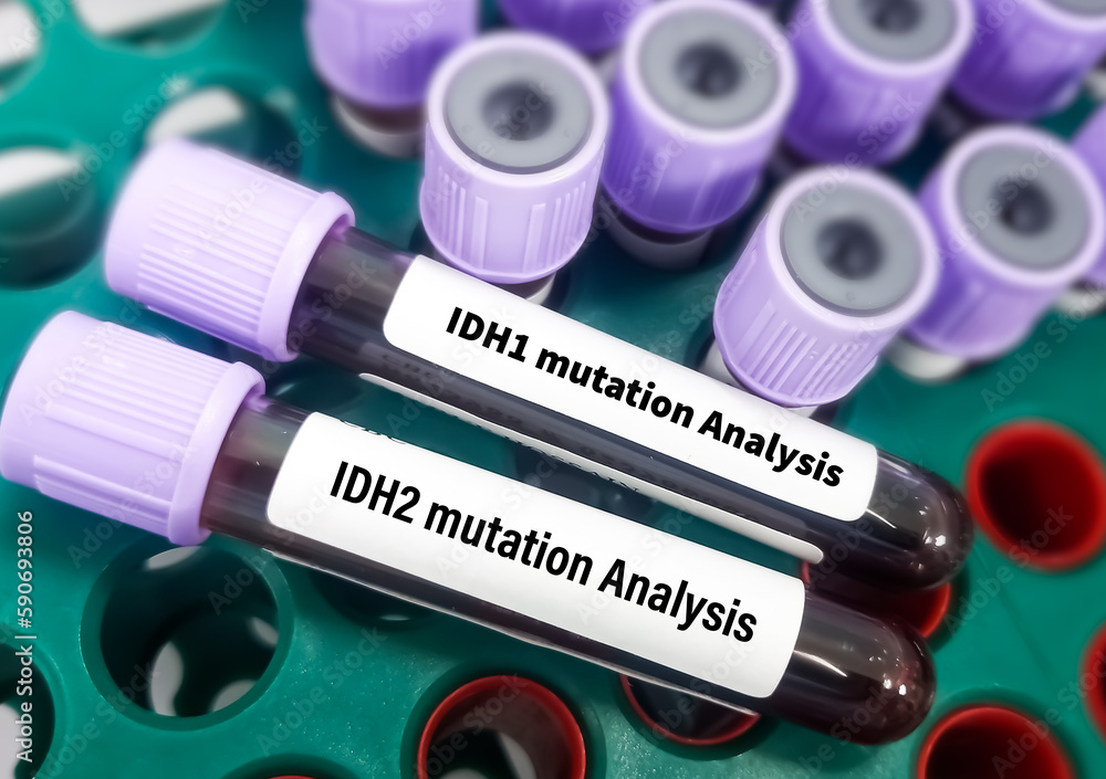 Blood sample for IDH1 and IDH2(isocitrate dehydrogenase) mutation ...