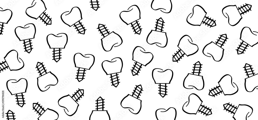 Dental implant, medically accurate or dental bridge. Cartoon healthy ...