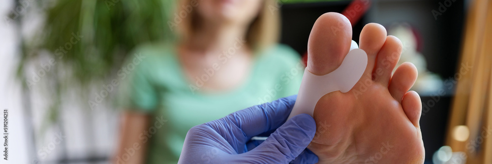 Doctor orthopedist examining leg with hallux valgus deformity of first ...
