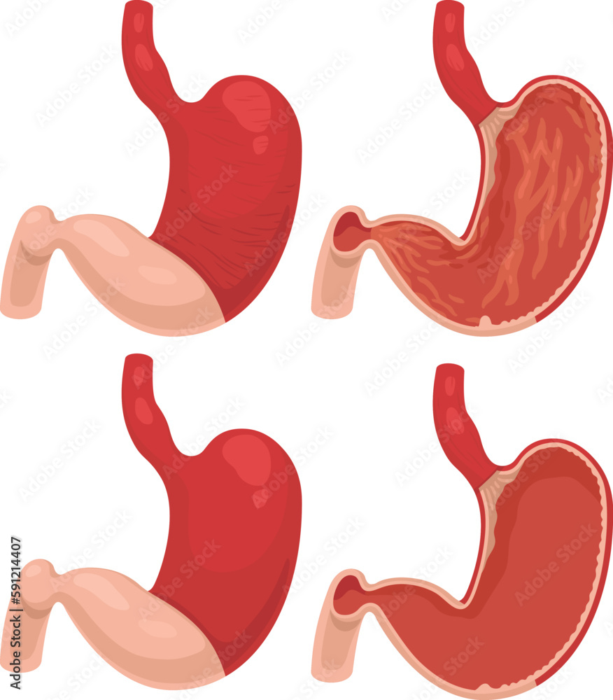 Vector illustration of stomachs in different views, the inner surface ...