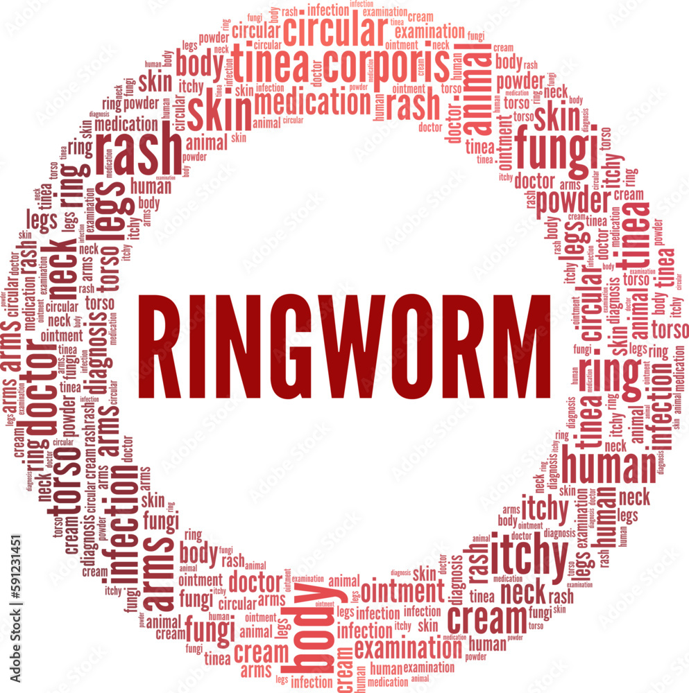 Tinea Corporis - Ringworm word cloud conceptual design isolated on ...