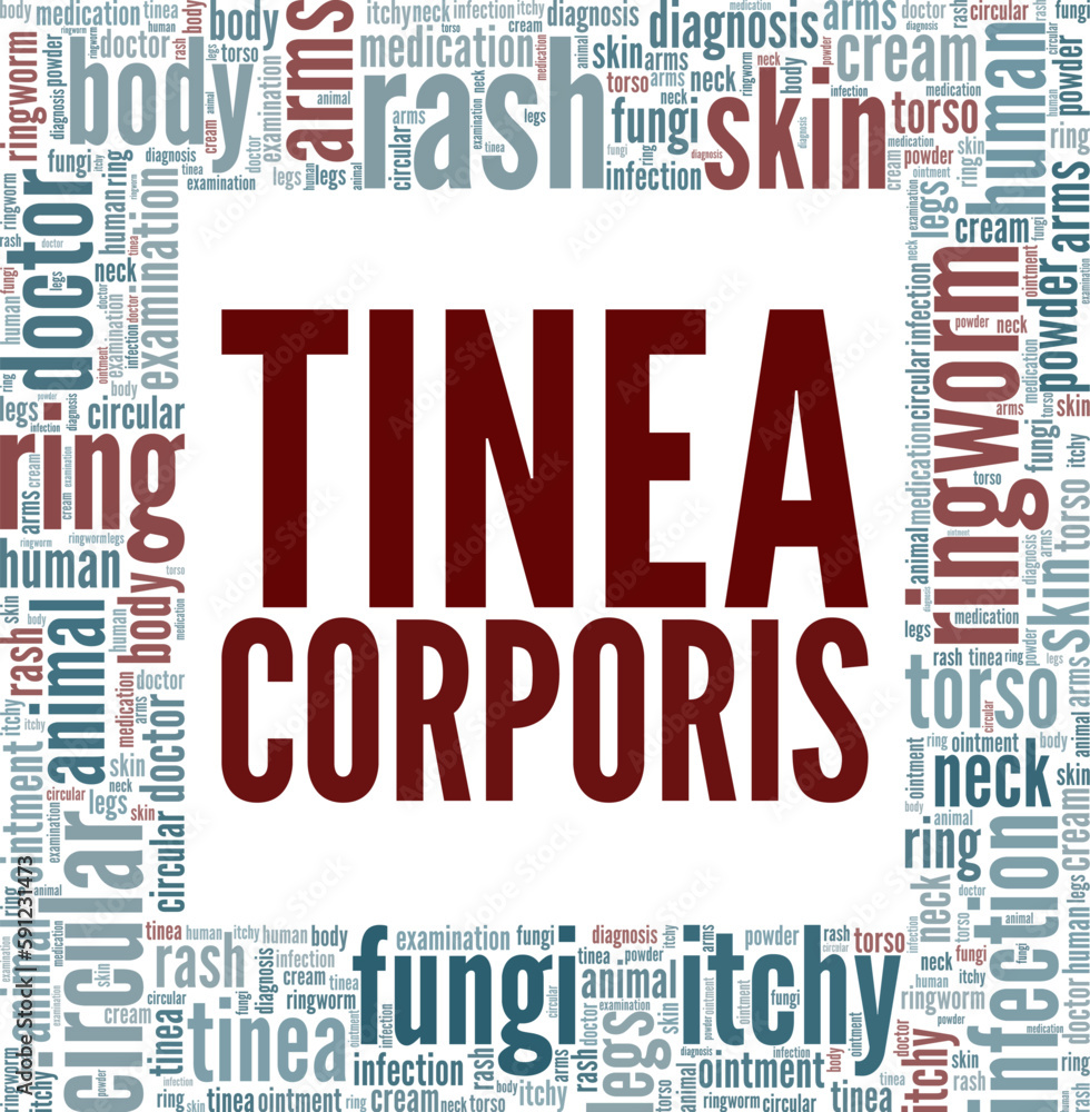 Poster Tinea Corporis - Ringworm word cloud conceptual design isolated ...