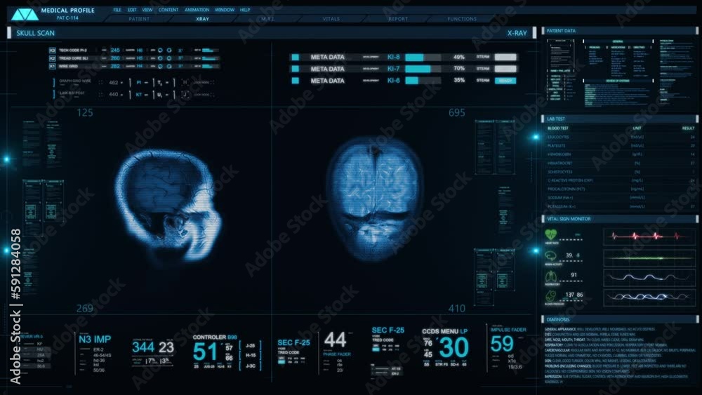 Futuristic Technological Interface Analyzing Human Anatomy. Medical ...