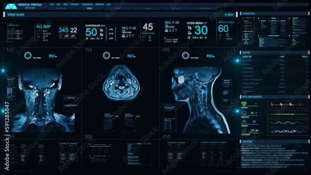 Medical Profile of Patient Showing Neck MRI Scan. Animation Showing Top ...