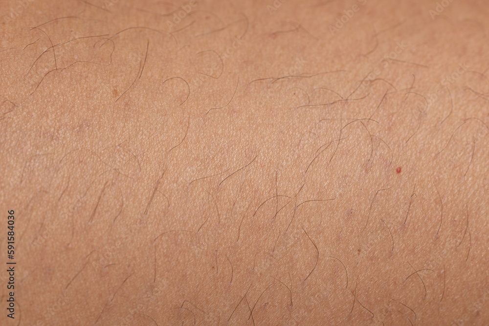 Full frame background human skin texture epithelium cells with hair and ...