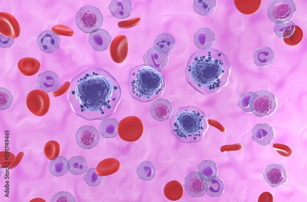 Acute myeloid leukemia (AML) cells in blood flow - isometric view 3d ...